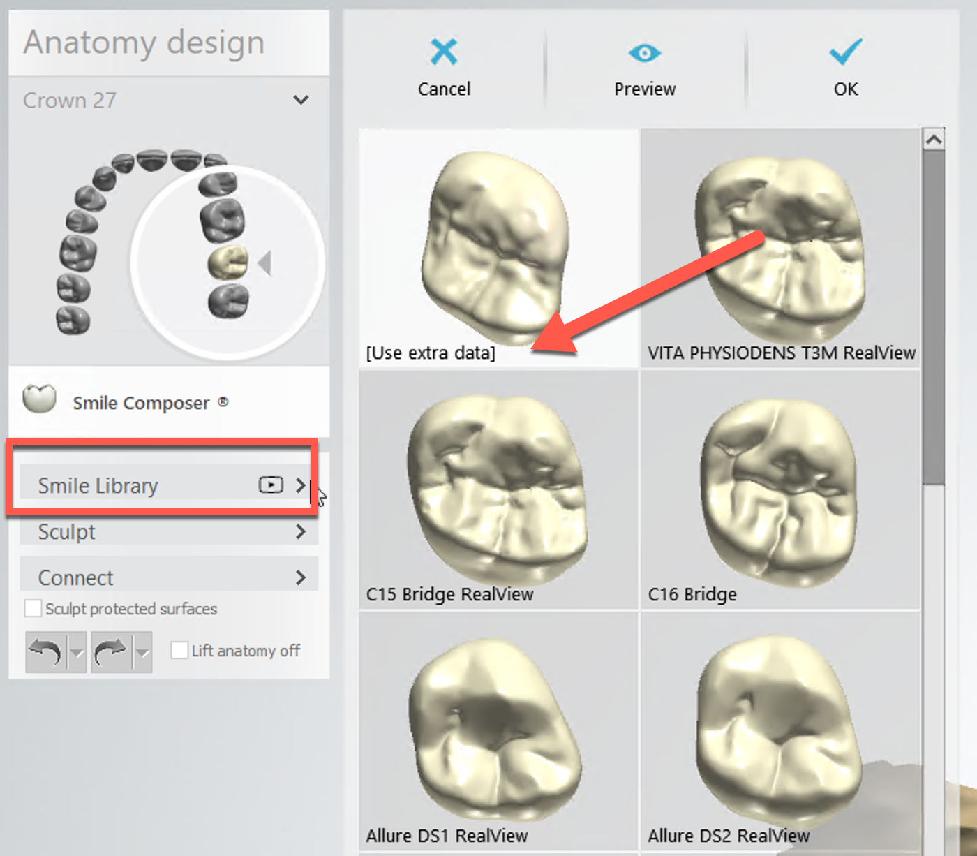 3Shape Automate - How to Upload, Download & Edit a 3Shape Automate ...