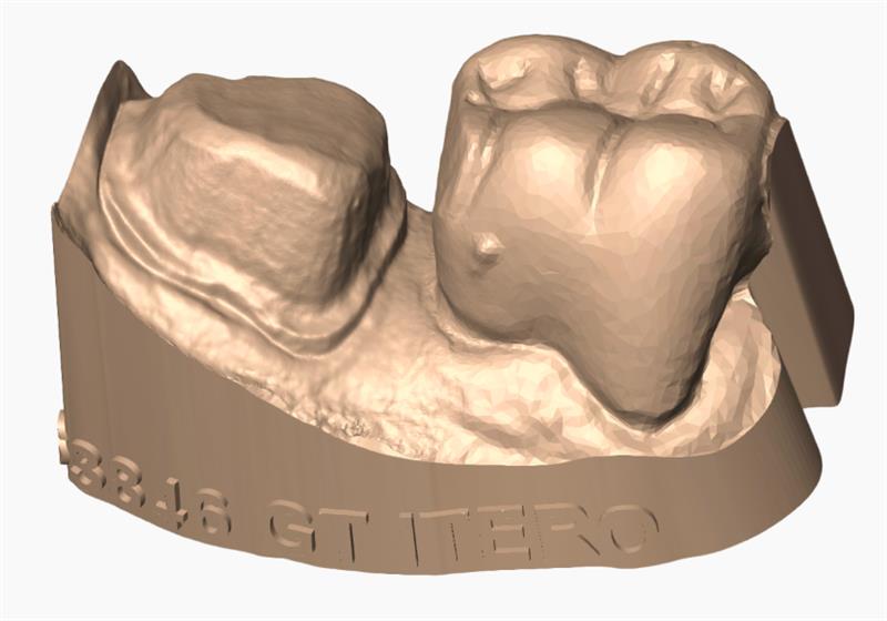 3Shape Automate - Model Generation under Crown Review – 3Shape Design ...