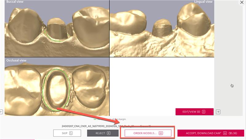 3Shape Automate - Model Generation under Crown Review – 3Shape Design Services