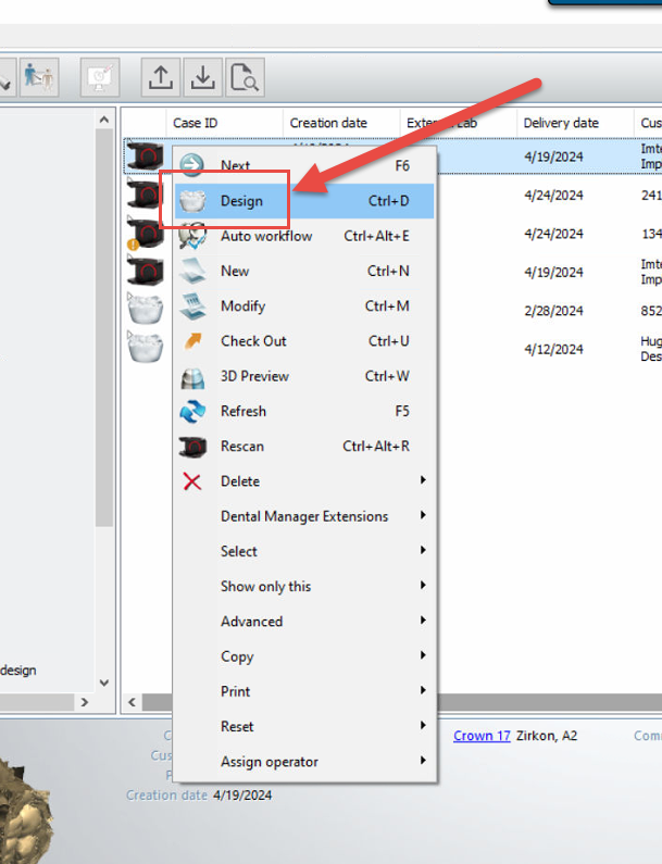 Dental Manager - How to pre-mark margins for design – 3Shape Design ...