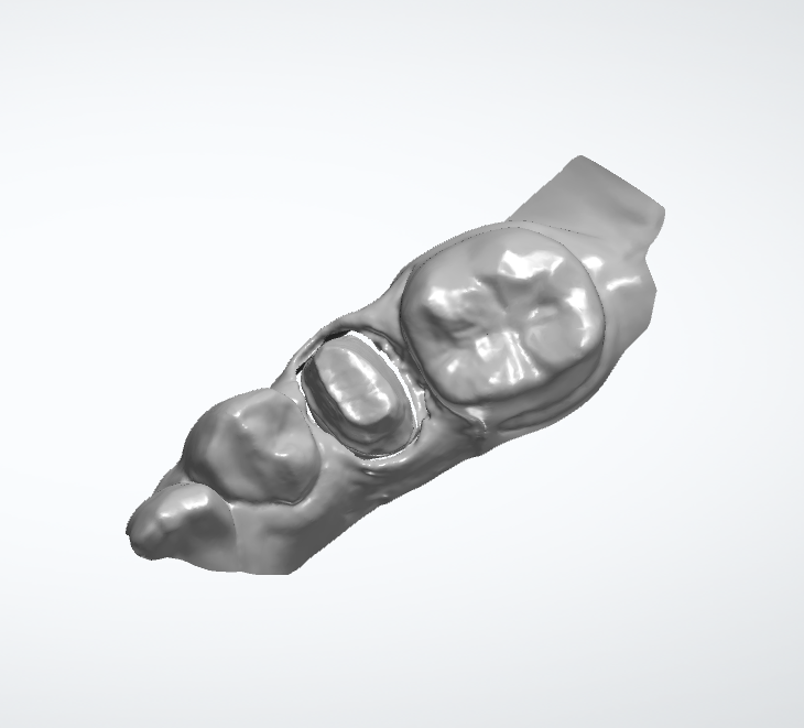 3Shape Automate - Hollowed Model Error – 3Shape Design Services