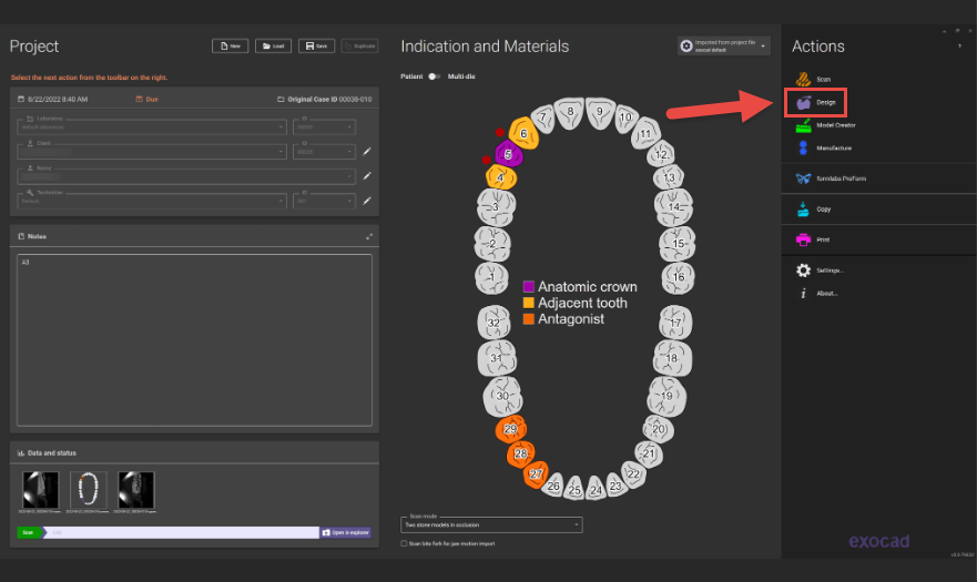 Exocad - How to submit implant cases – 3Shape Design Services