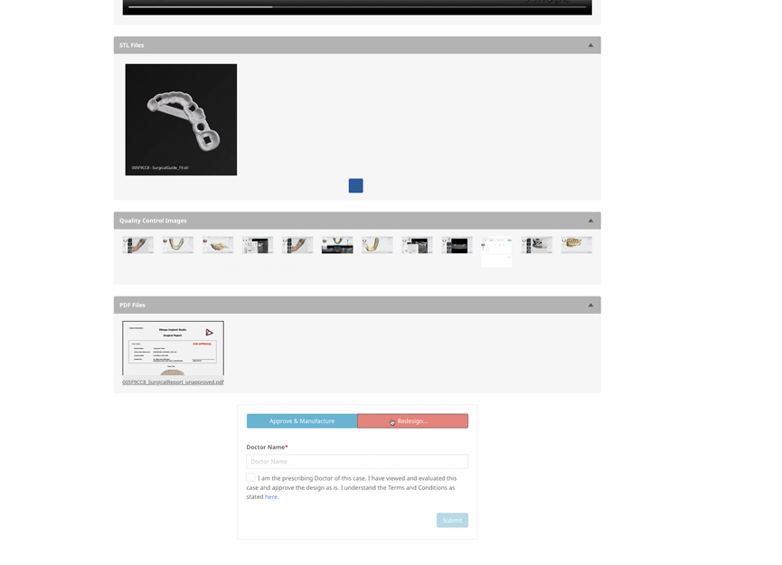 Guided Implant Surgery - How to Approve a case – 3Shape Design Services