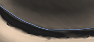 Trios - How to set the margin line automatically using Trios – 3Shape ...