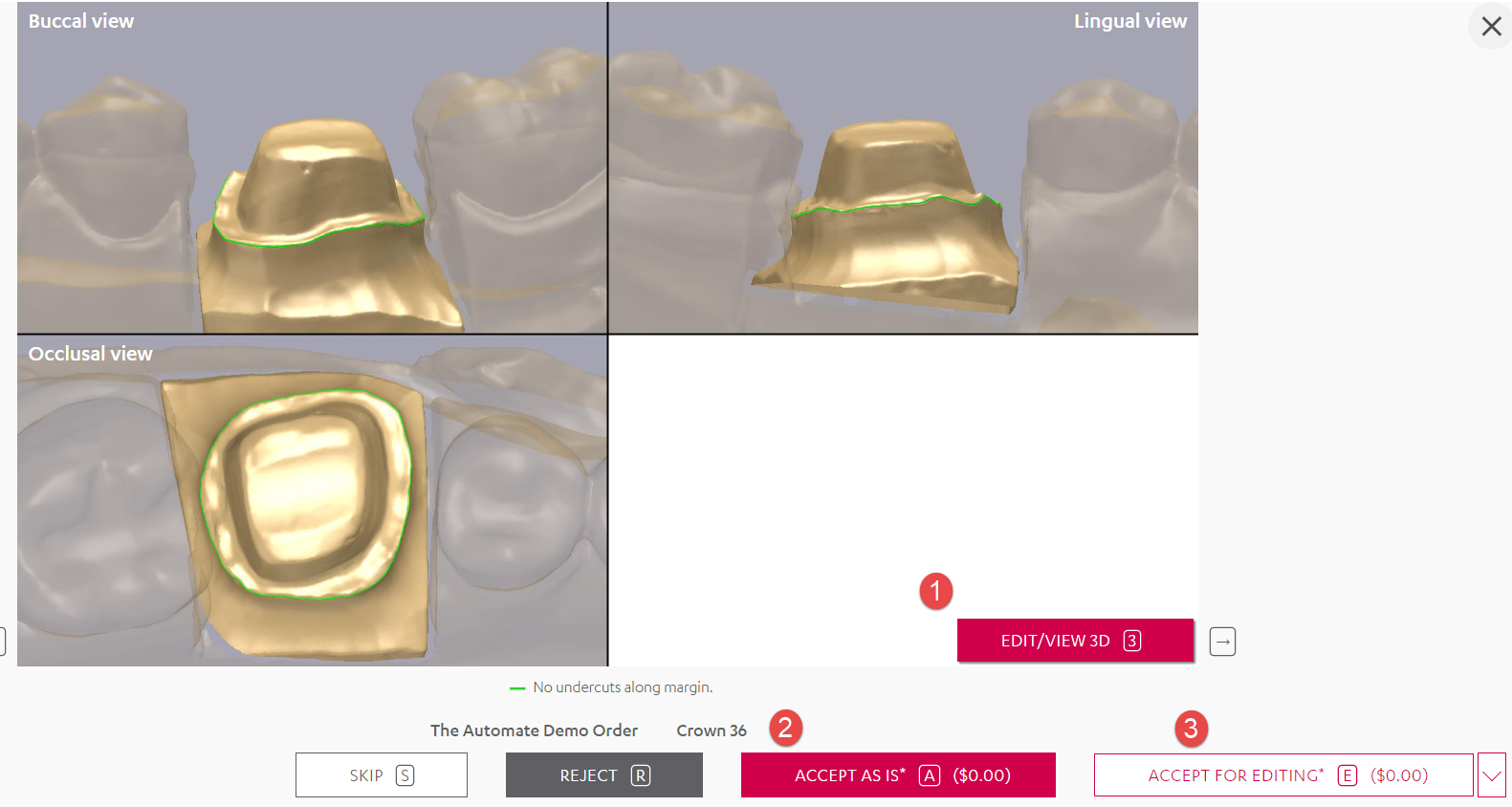 3Shape Automate - How to send a Demo Case – 3Shape Design Services