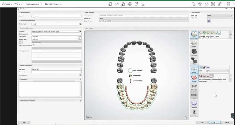 Dentures - Copy Denture Offering - Overview and Important Aspects ...
