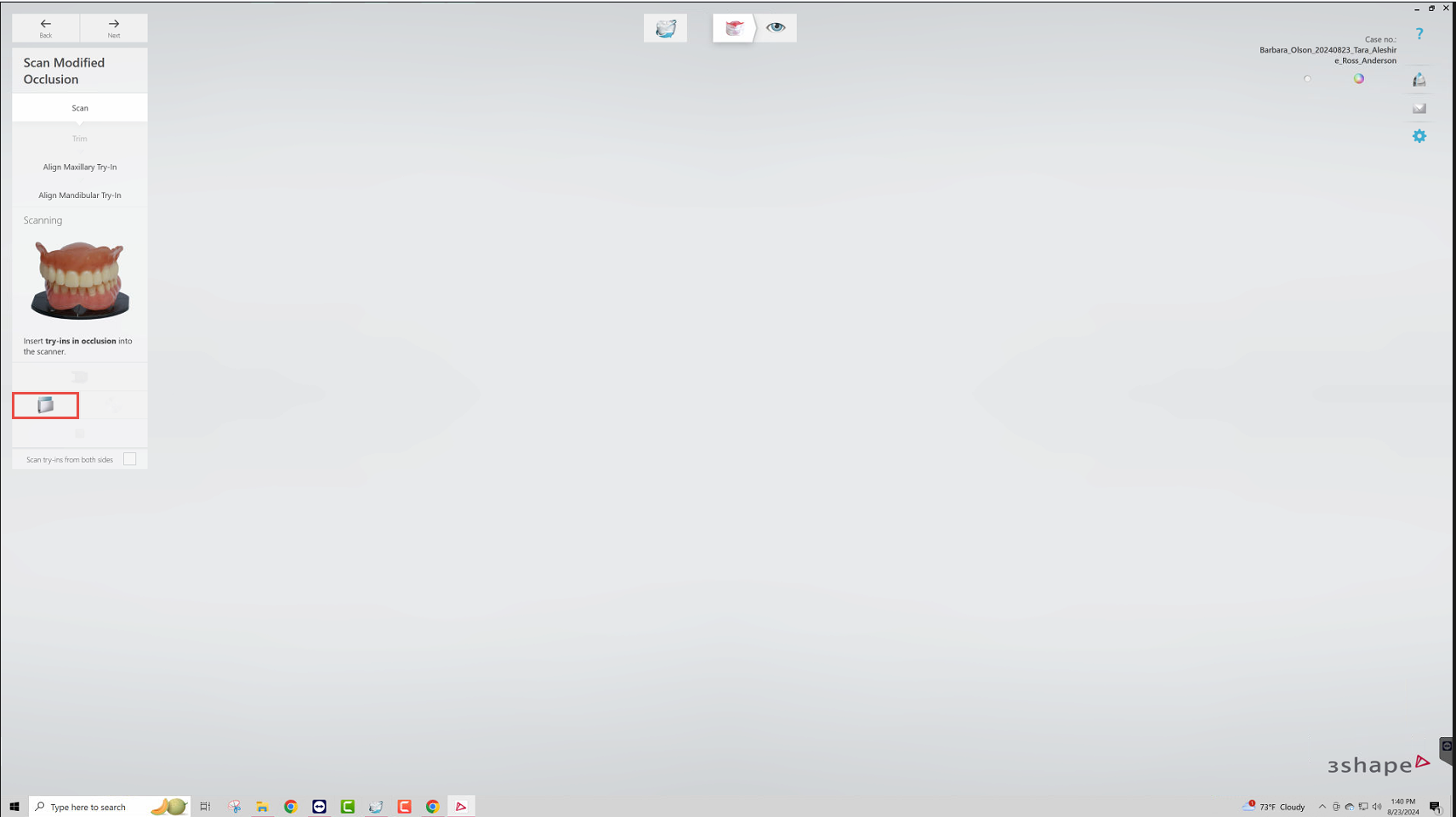 Dentures - Bite adjustments - Protocol Supported for Stone Models ...