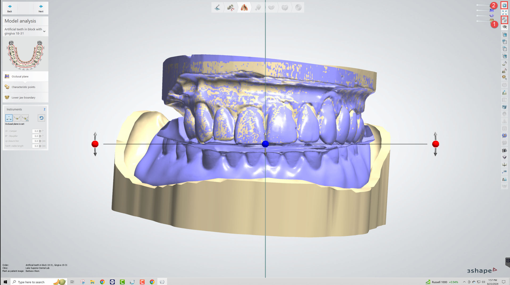 Dentures - Bite adjustments - Protocol Supported for Stone Models ...