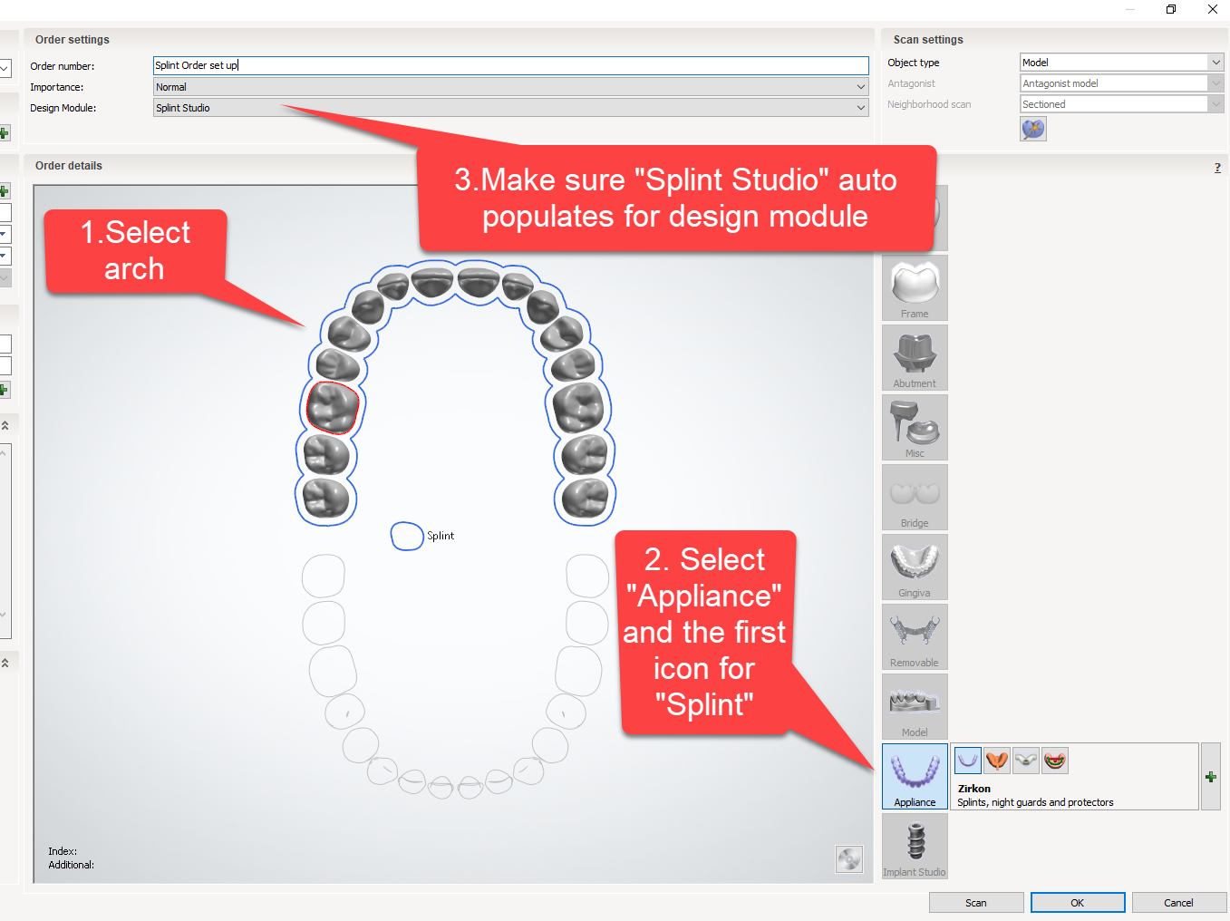 Sports Guards - Sending a Sports Guard Case to the 3Shape Design ...
