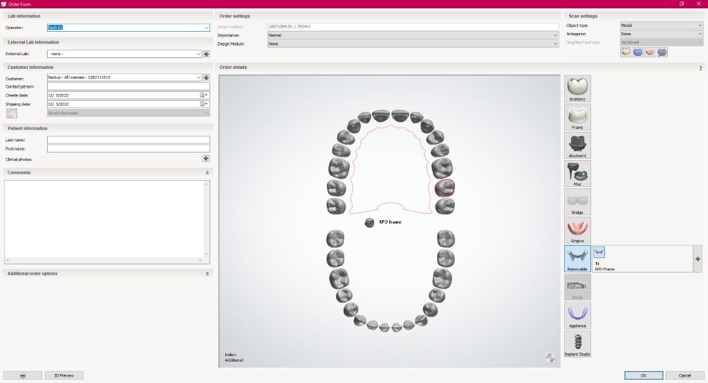 Removable Partial Dentures - Sending an RPD Case to the 3Shape Design ...