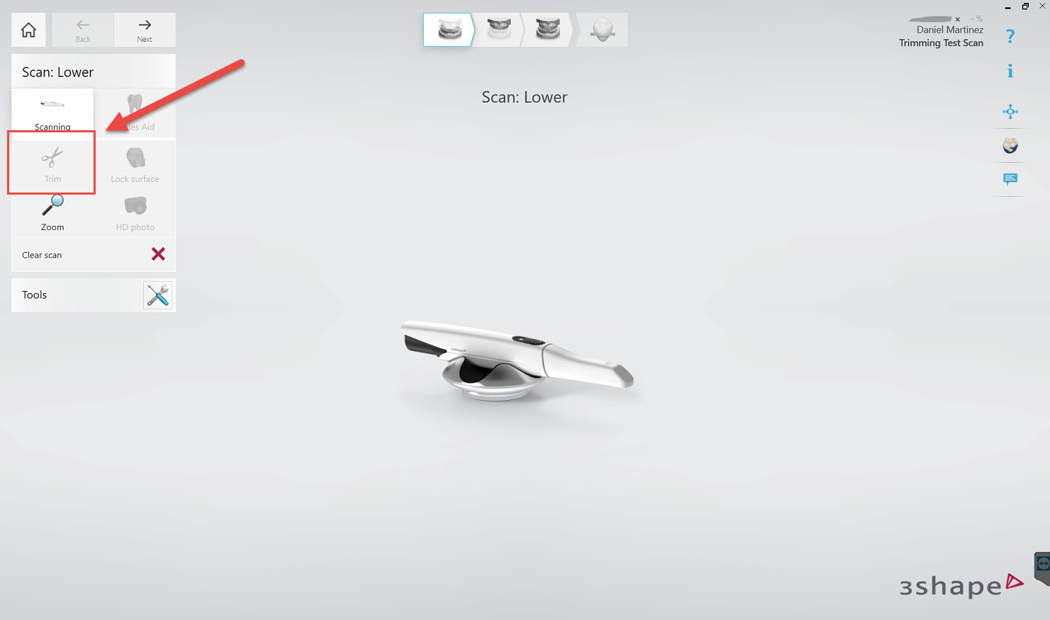3Shape Unite - How to trim scans for Automate Cases – 3Shape Design ...