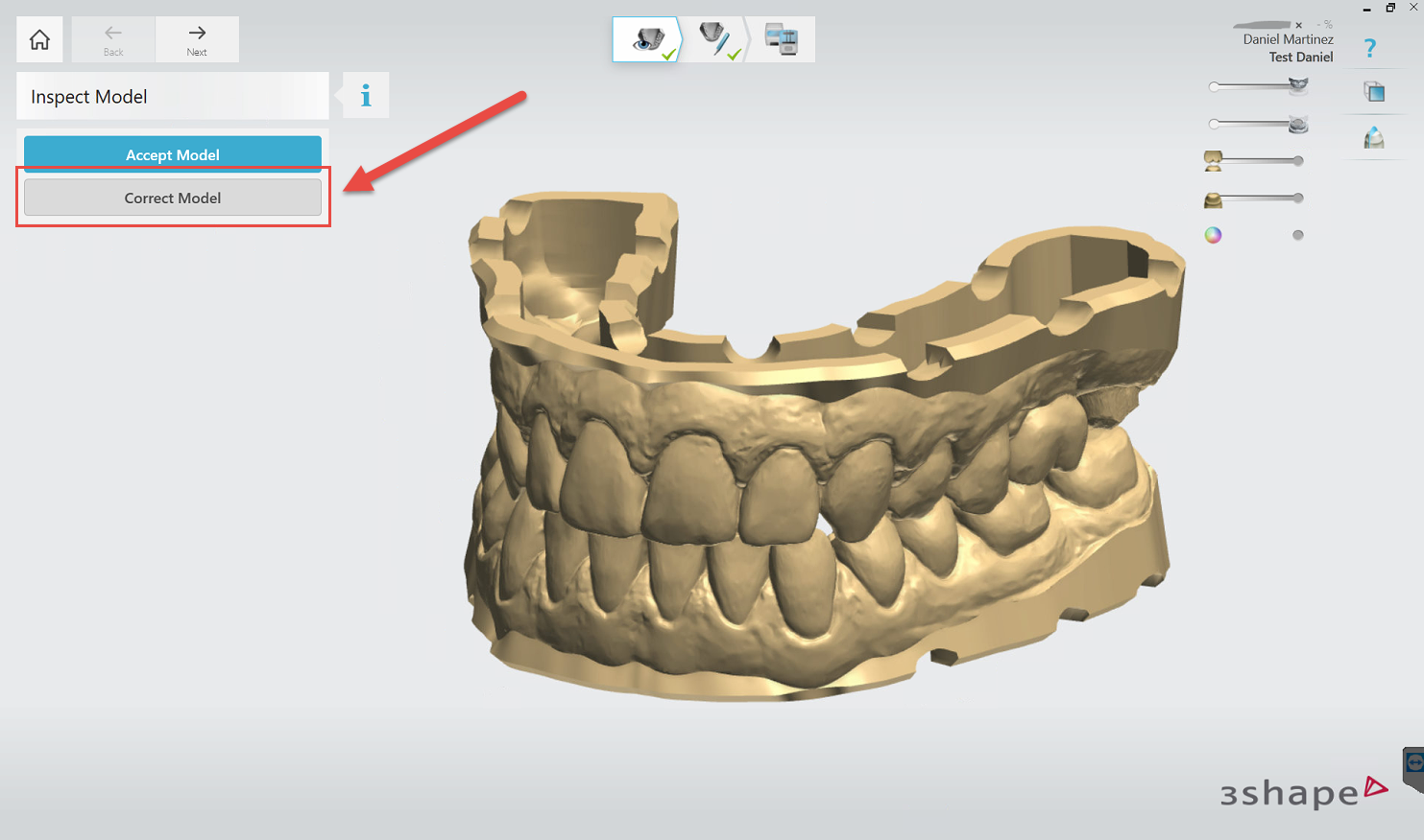 3Shape Unite - How to trim scans for Automate Cases – 3Shape Design ...