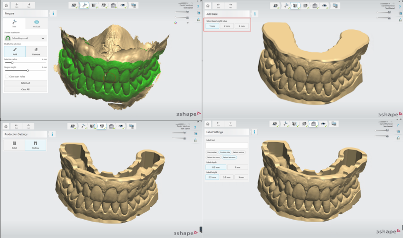 3Shape Unite - How to trim scans for Automate Cases – 3Shape Design ...