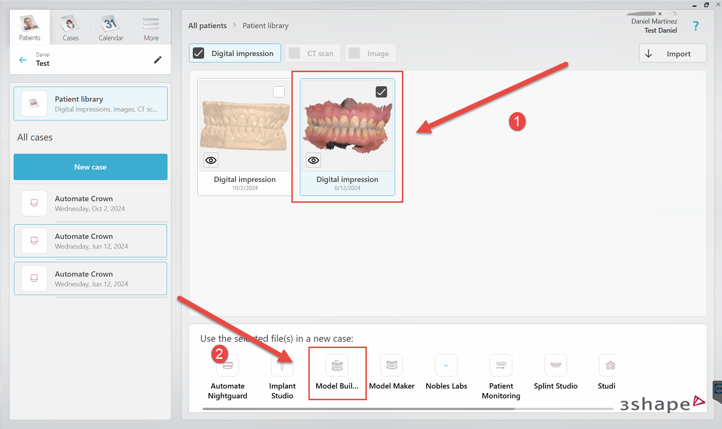 3Shape Unite - How to trim scans for Automate Cases – 3Shape Design ...