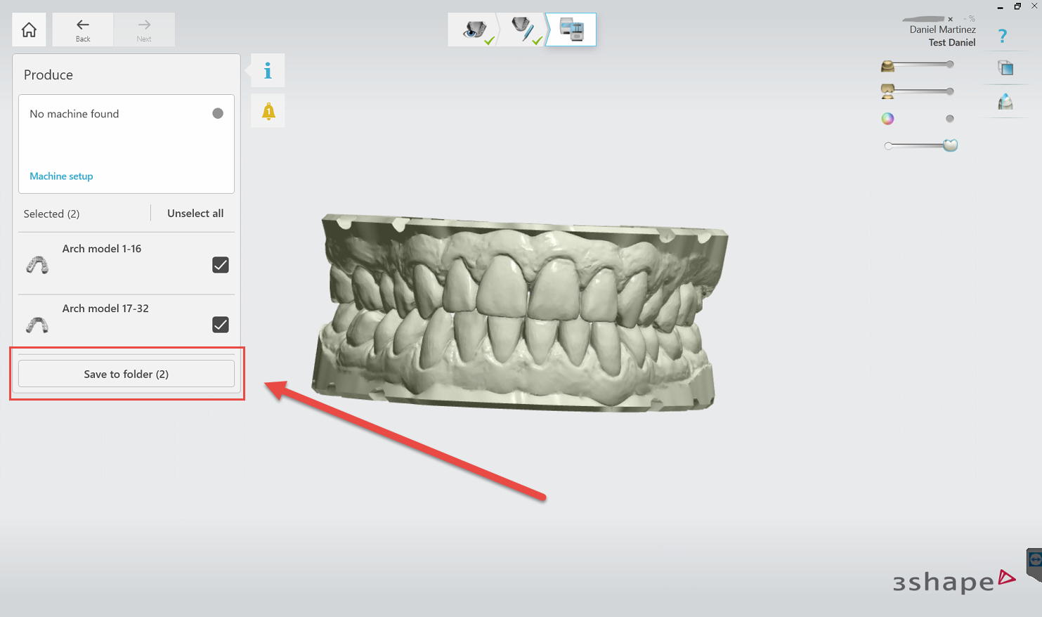 3Shape Unite - How to trim scans for Automate Cases – 3Shape Design ...