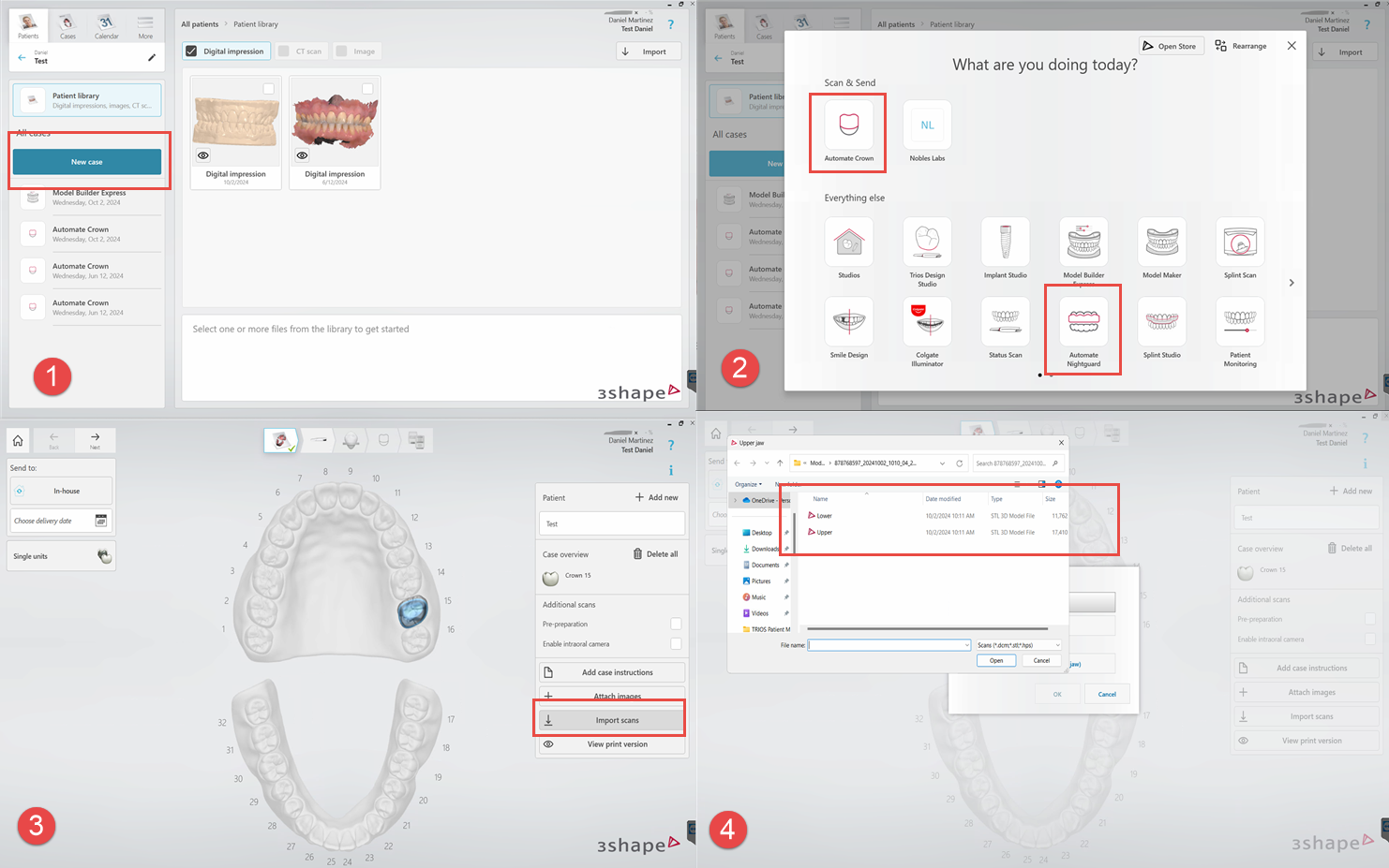 3Shape Unite - How to trim scans for Automate Cases – 3Shape Design ...