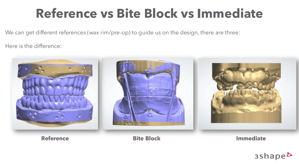 Dentures - Requirements for the existing denture to be used as a ...