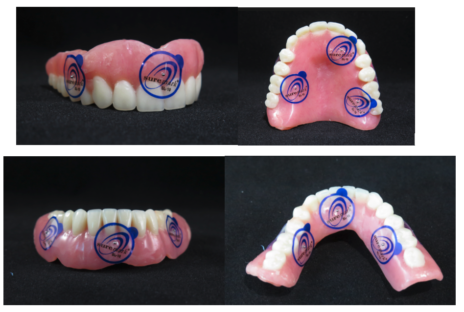 Guided Implant Surgery - Dual Scan Protocol – 3Shape Design Services