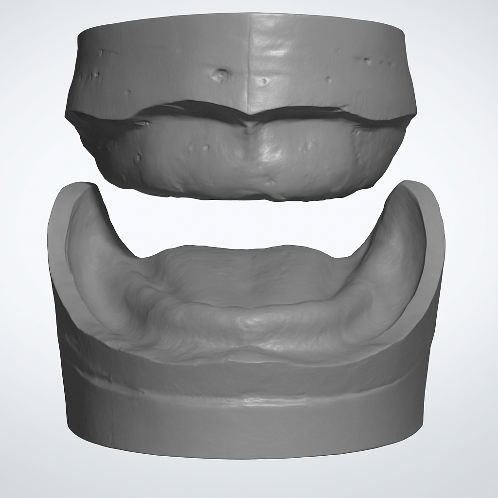 Dentures - Economy Denture Offering - Overview and Important Aspects ...