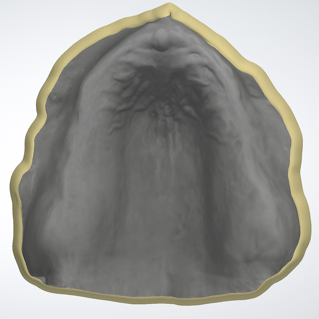 Dentures - Ivotion Denture Offering - Overview and Important Aspects ...