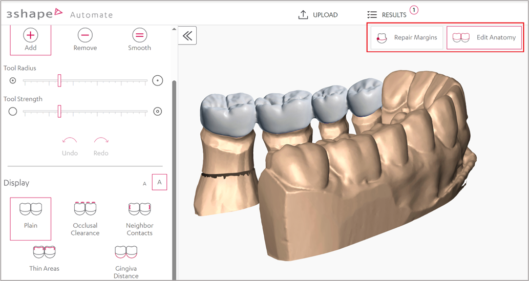 How to send an Automate Bridge – 3Shape Design Services