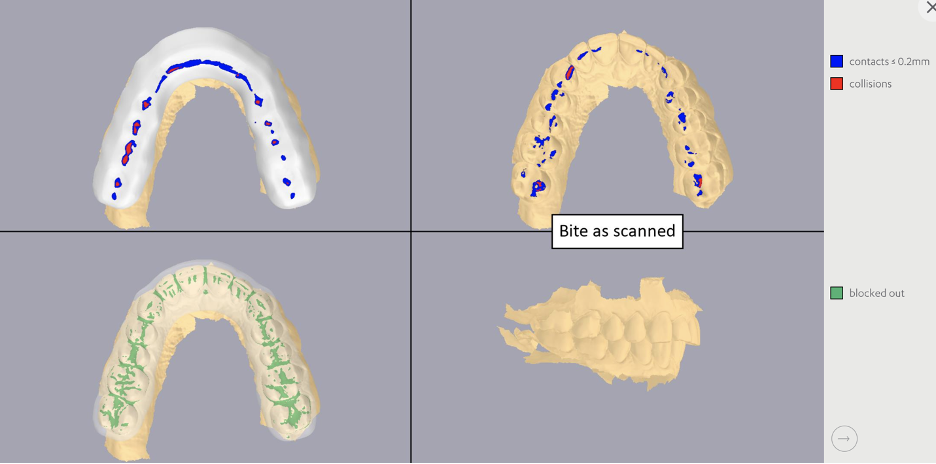 3Shape Automate - How to Send Nightguards – 3Shape Design Services