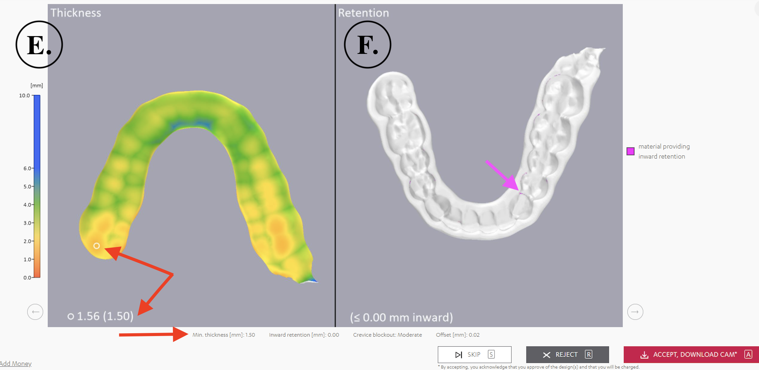 3Shape Automate - Nightguard QC Photo Breakdown – 3Shape Design Services