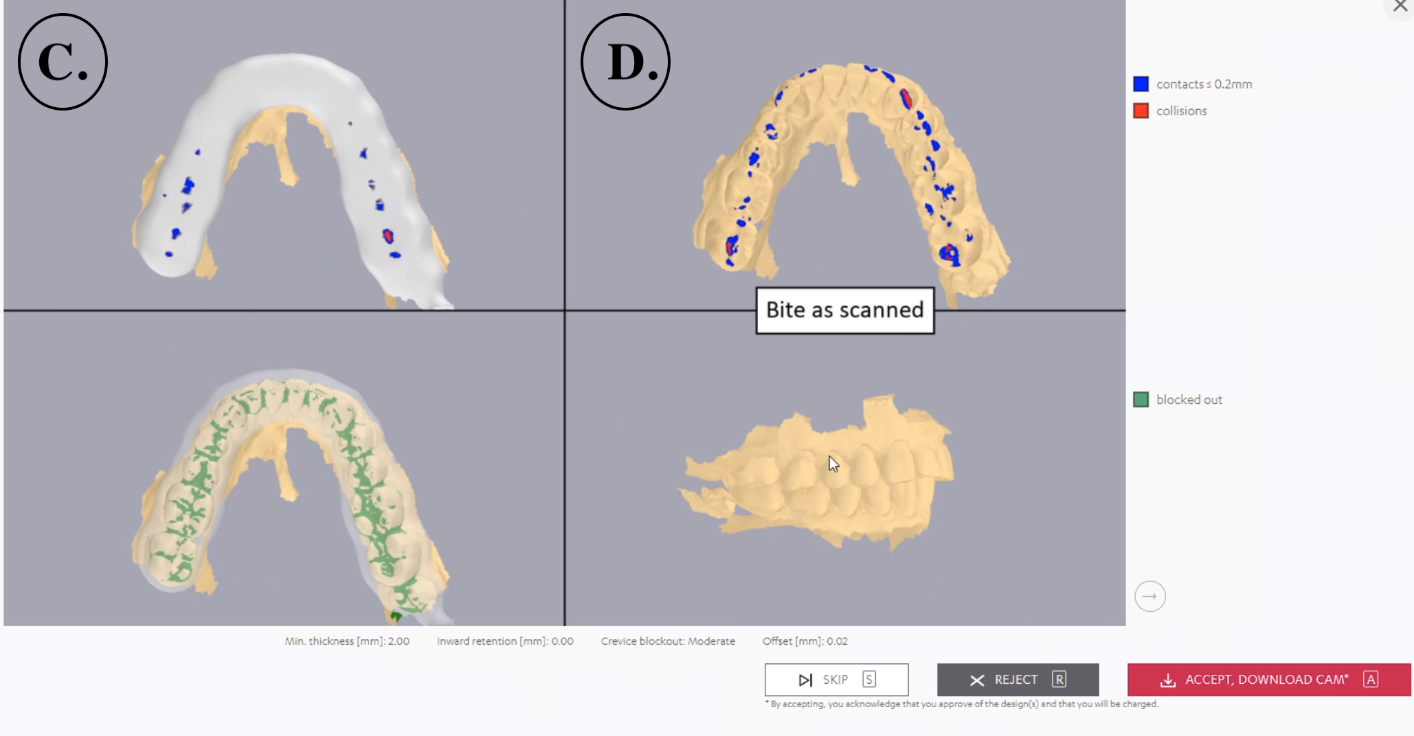 3Shape Automate - Nightguard QC Photo Breakdown – 3Shape Design Services
