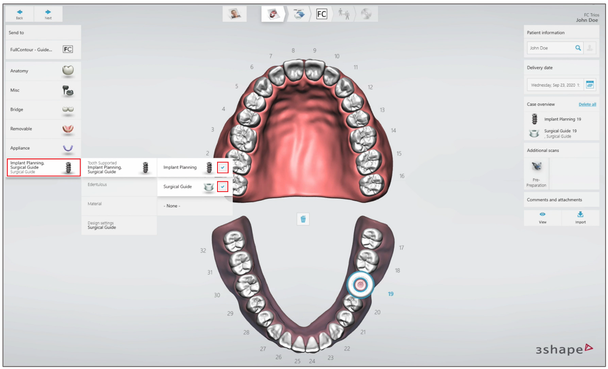 Guided Implant Surgery - 3Shape Communicate workflow for Guided Surgery – 3Shape Design Services