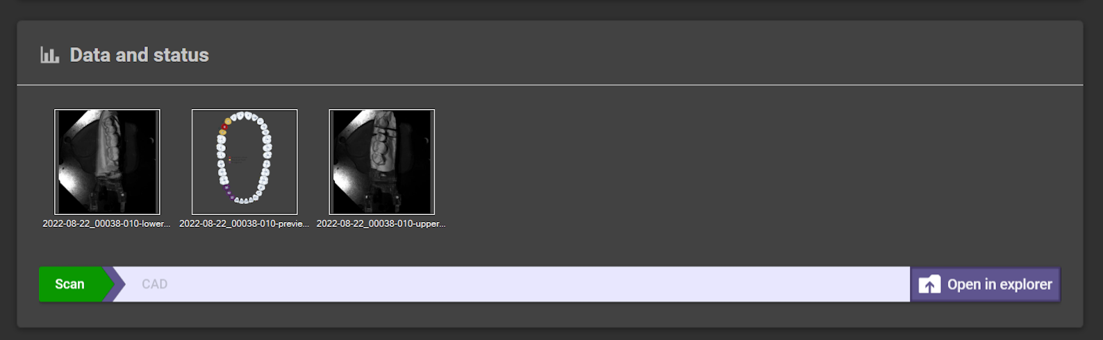 3Shape Automate - Exocad Order Workflow – 3Shape Design Services