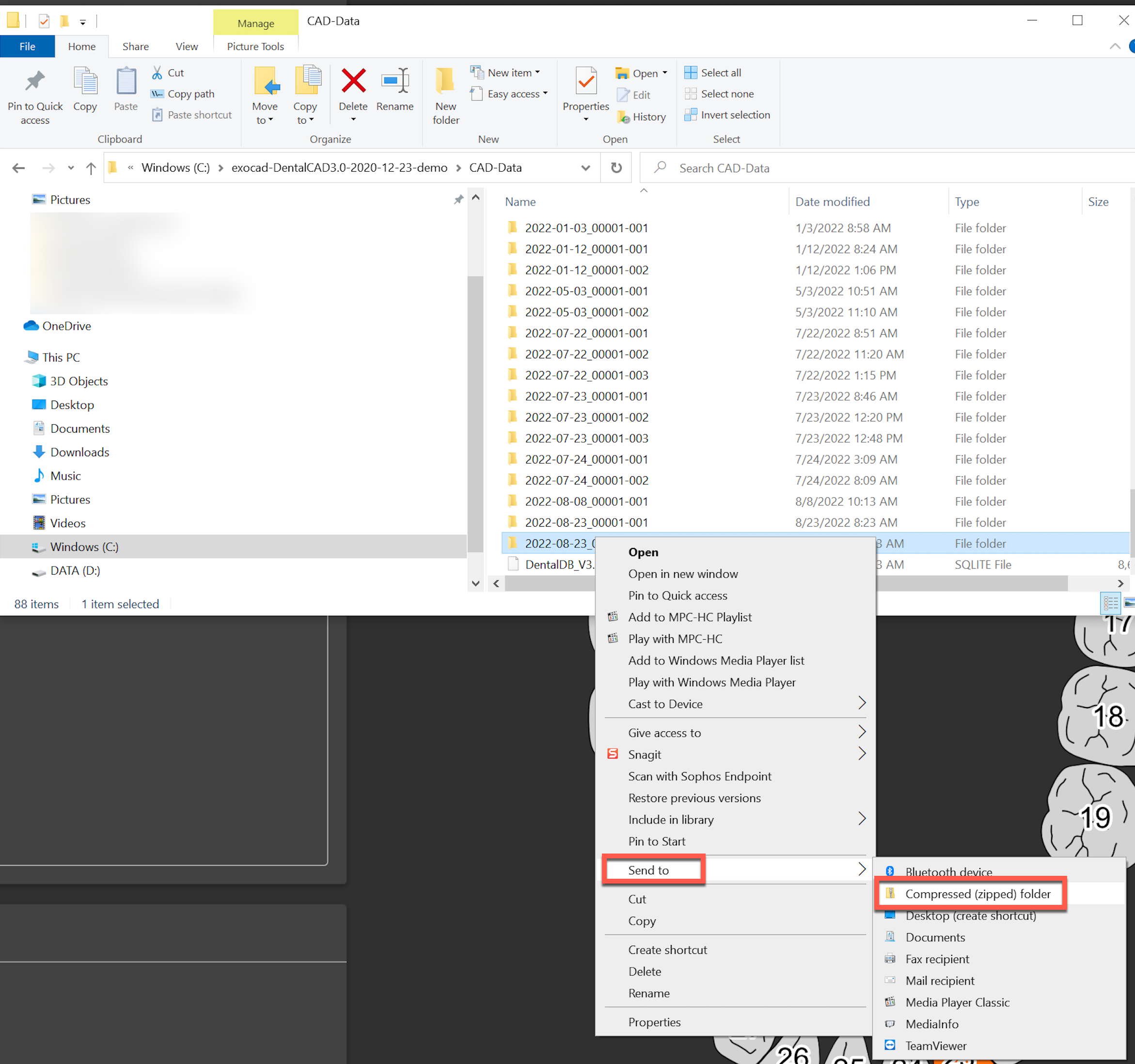 3Shape Automate - Exocad Order Workflow – 3Shape Design Services